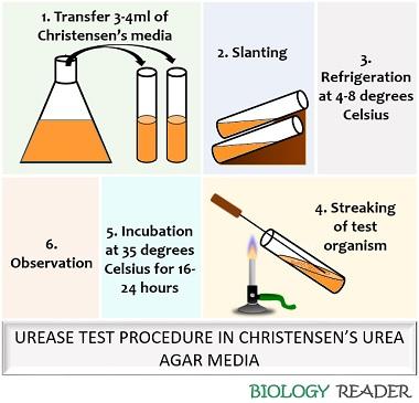 What is Urease Test? Definition, Principle, Procedure & Test Results ...