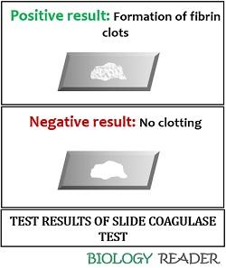 What is Coagulase Test? Definition, Overview, Principle & Procedure ...